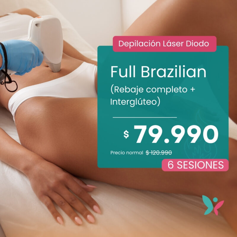 Rebaje completo + Interglúteo (Full brazilian) | Depilación Láser - Depilsoft